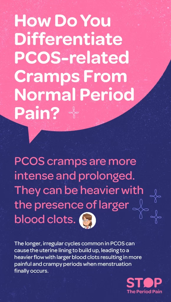 How Do You Differentiate PCOS-related Cramps From Normal Period Pain?